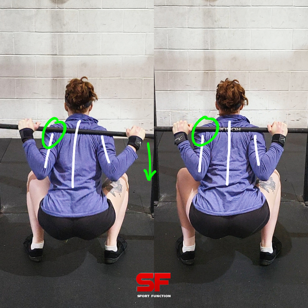 Movement Assessment – Sport Function